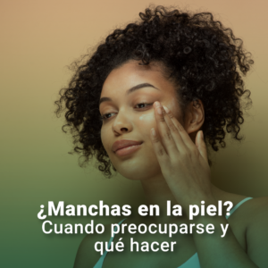 ¿Manchas en la piel? Cuando preocuparse y qué hacer - Diagnosticar IPS ...